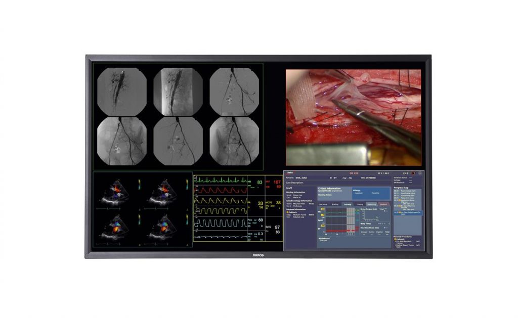 Barco Surgical Displays – Medequal Systems & Supplies Inc.